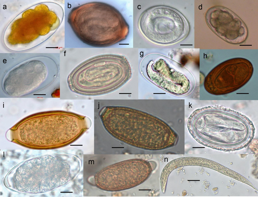 How to get rid of intestinal parasites in human - NewsPaperla